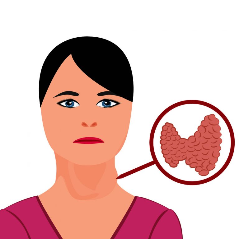 What is Hypothyroidism? - Edmonds Medical Clinic