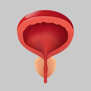 BPH (Benign Prostatic Hyperplasia) - Edmonds Medical Clinic